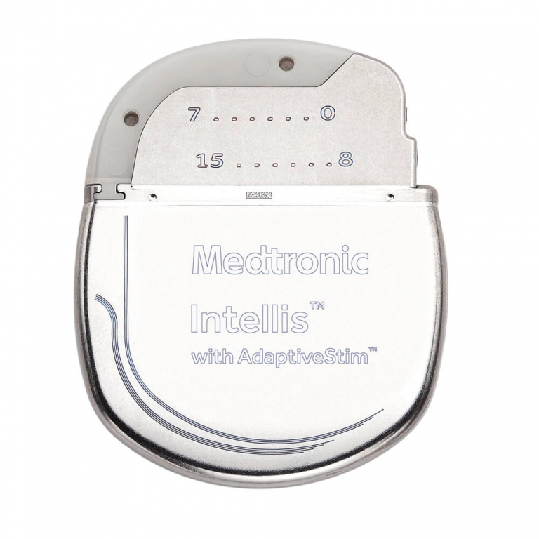 Bomba implantable de infusión intratecal para tratamiento de dolor ...